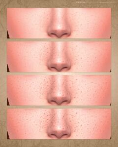 Freckles 37 HQ By Carolldesign Sims 4 CC Download